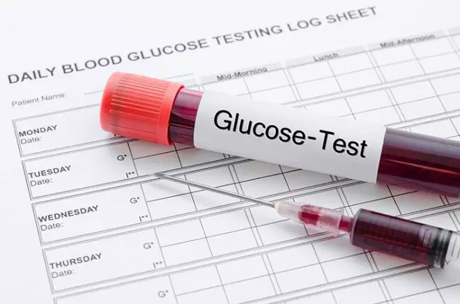 Hyperglycemia: karuwa a cikin glucose jini, yana haifar da ganewar asali, cututtukan fata 10995147_1