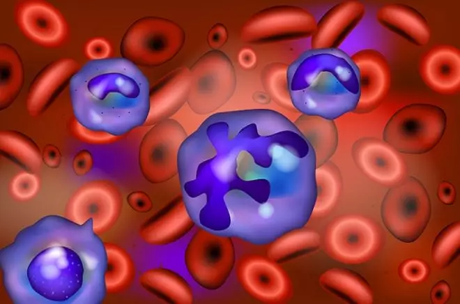 Neutroofilez - peningkatan neutrofil darah: jenis neutrofil, penyebab neutrofiliz, diagnosis 10995564_2