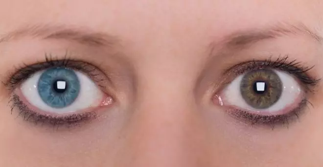 Heterochromia. 11021765_3