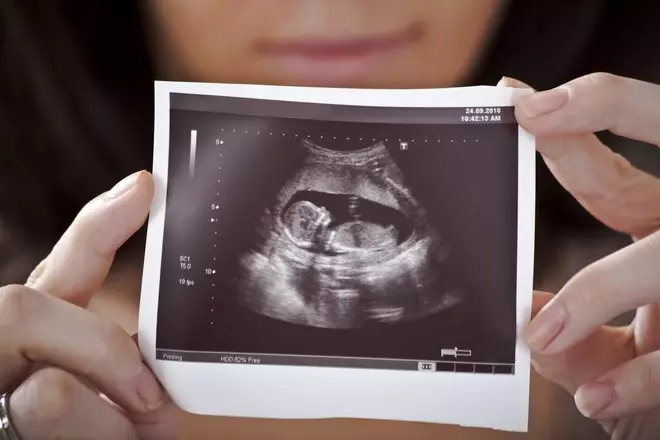 Examen médico a las 30 semanas de embarazo.