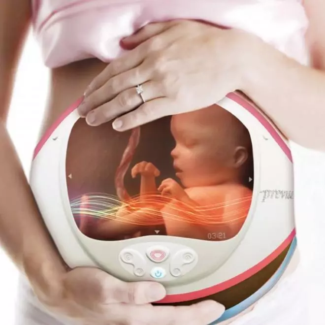 Įdomiausi nėščioms moterims išradimai yra įtaisų ir naudingų dalykų apžvalga. 14_4