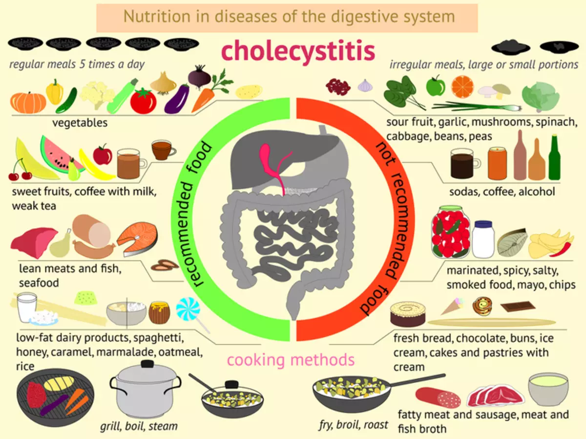 Vroue Cholecystitis