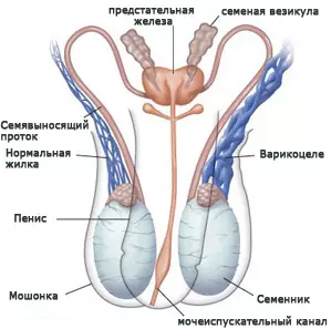 Varicocele en nens