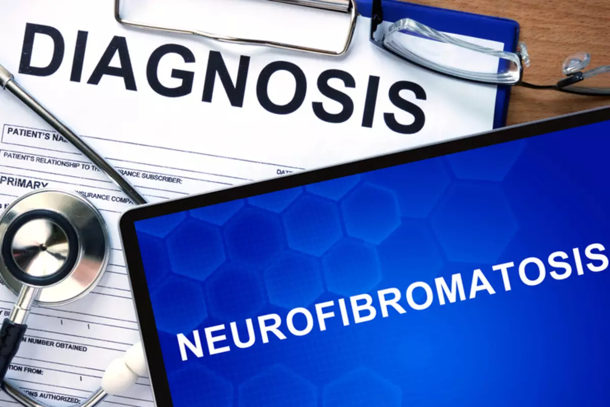 Neurofibromatososis ចំពោះកុមារ