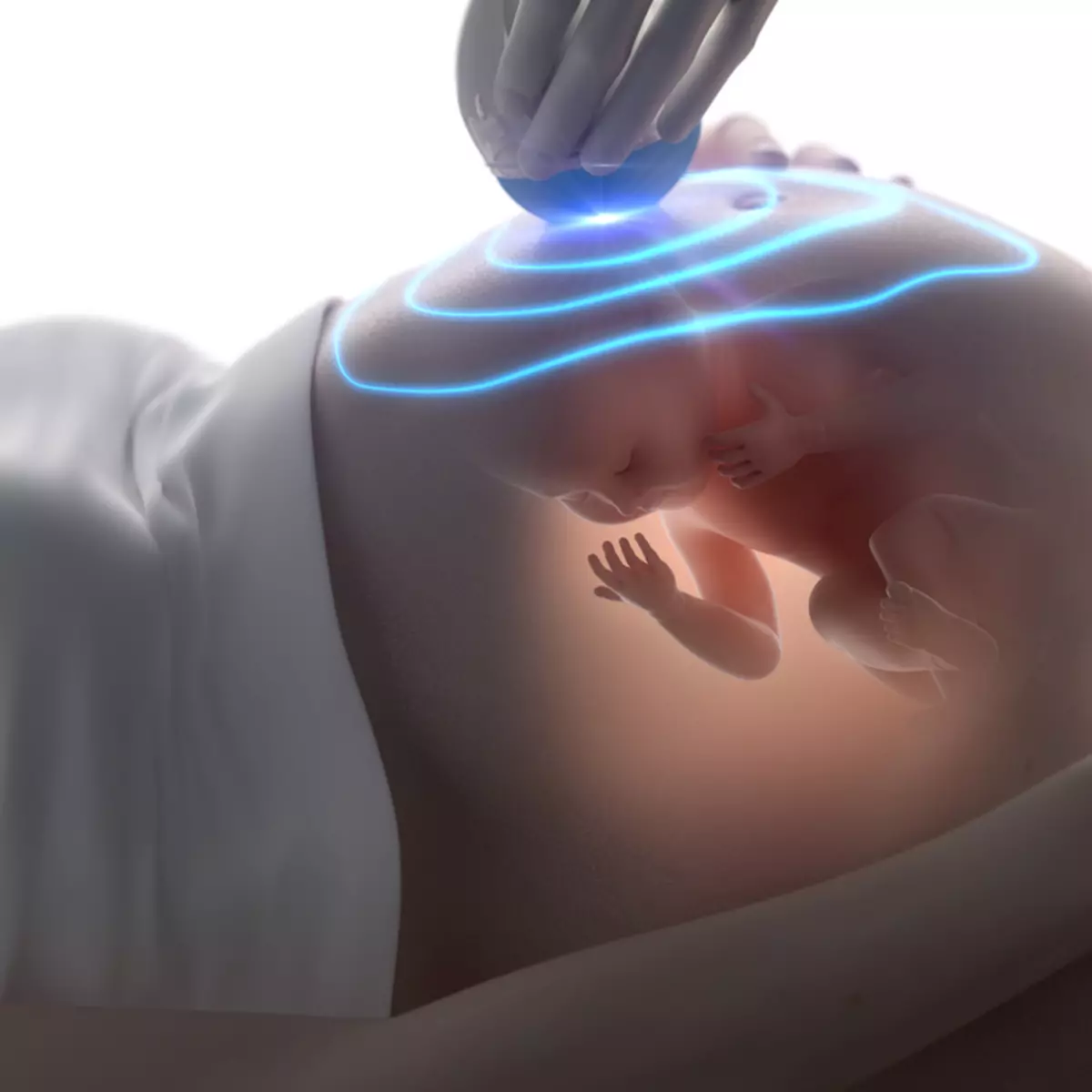 Προγεννητικό εμβρυϊκό θάνατο
