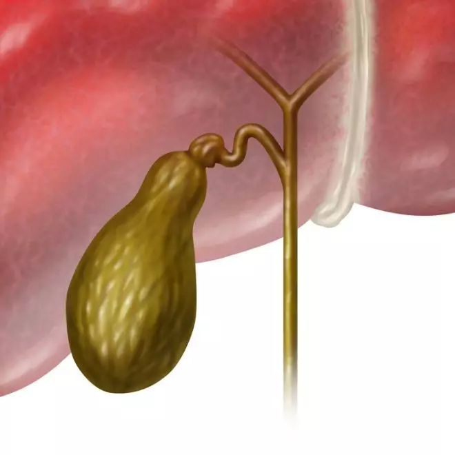 ஒரு குழந்தையின் பித்தப்பைகளை சிதைத்தல்