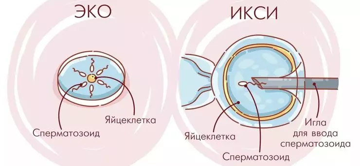 Kedu ihe dị iche