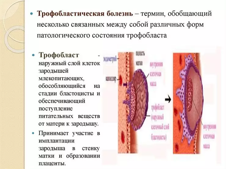 Gaixotasun trofoblastikoa ginekologian