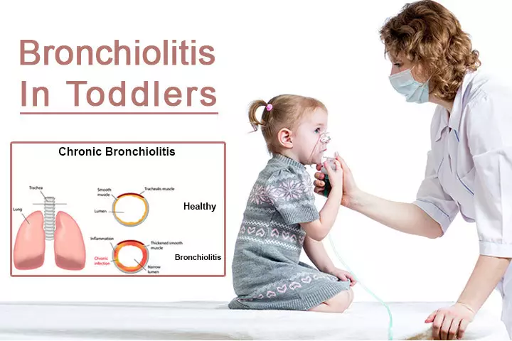 Lacing bronchiolitis: nyedhaki kanggo nyegah lan terapi