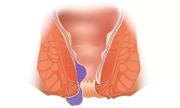 କାରଣଗୁଡିକ