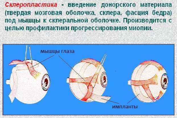 بالىلارنىڭ تەۋرىنىش