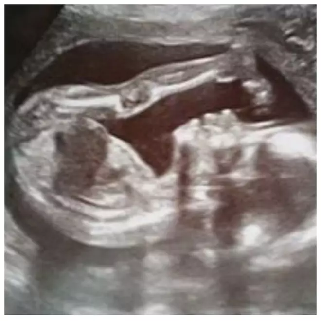 Snapshots Unusual Ultrasound