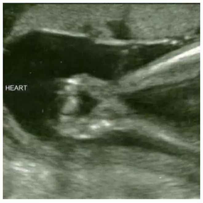 Snapshots Unusual Ultrasound