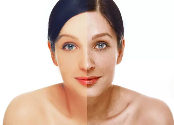 Kako poboljšati boju lica