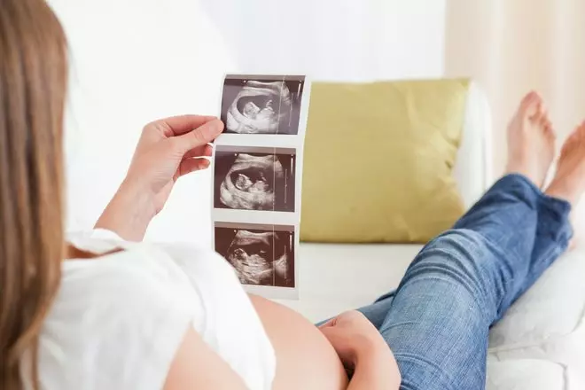 5 Wege, um das Baby im Bauch in der Mutter zu rühren 426936_1