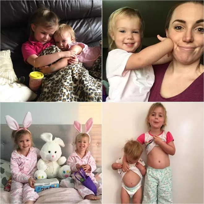 Honestly: Moms tell about changing breast shape after feeding 60412_6