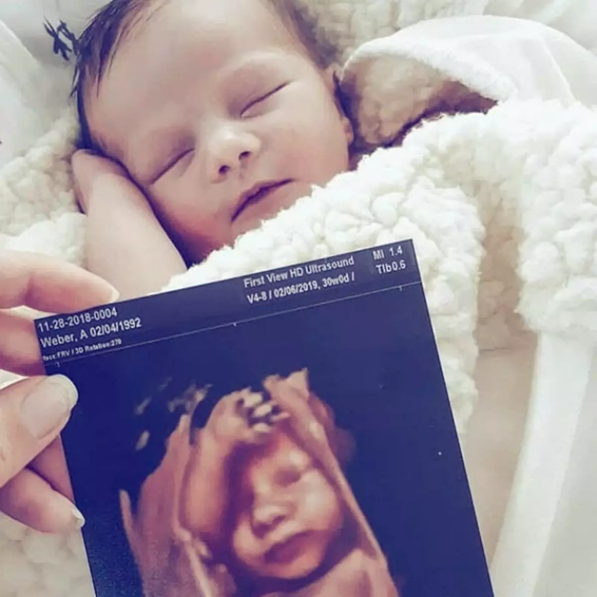 Um ginecologista obstetra é dividido por fotos de bebês nos primeiros minutos após o nascimento. 643339_7