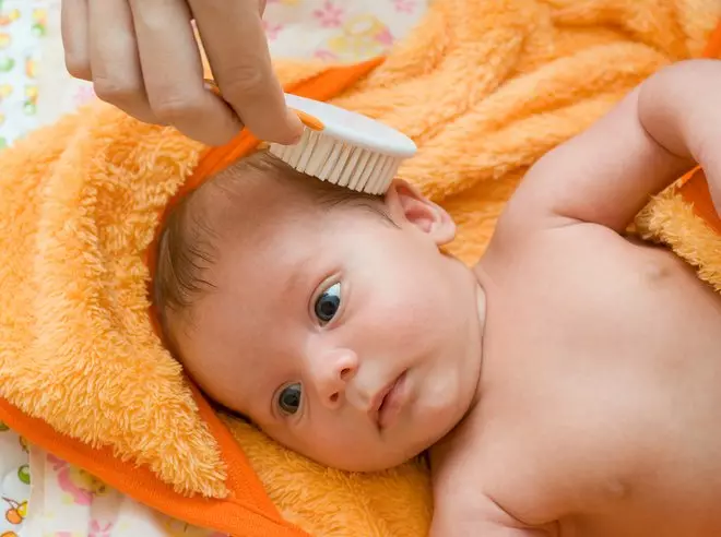 Pediatrician suosittelee: Miten päästä eroon vauvan päähän 83678_1